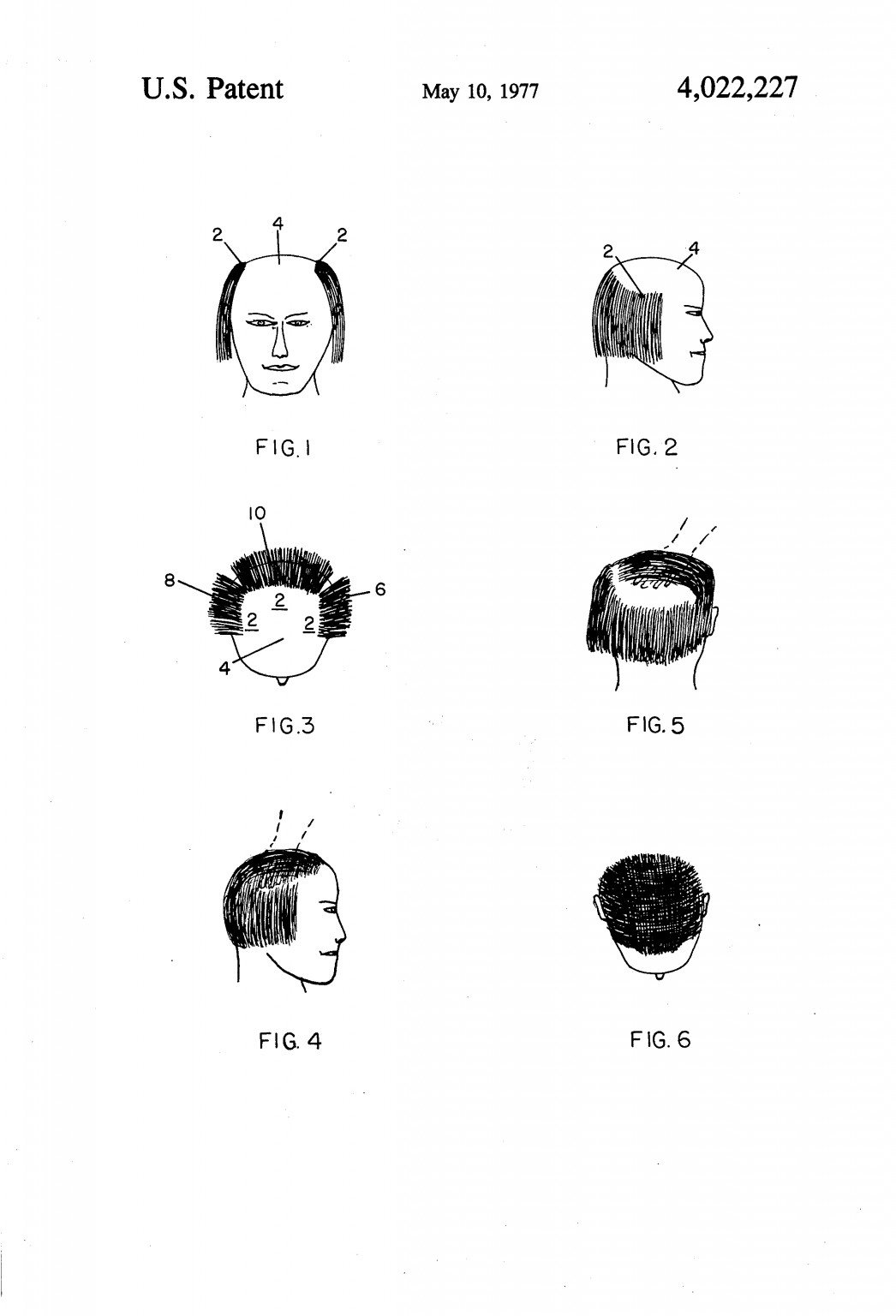 The Rise, Flop and Fall of the Comb-Over