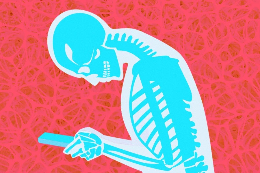 I’ve Been Diagnosed With ‘Text Neck’