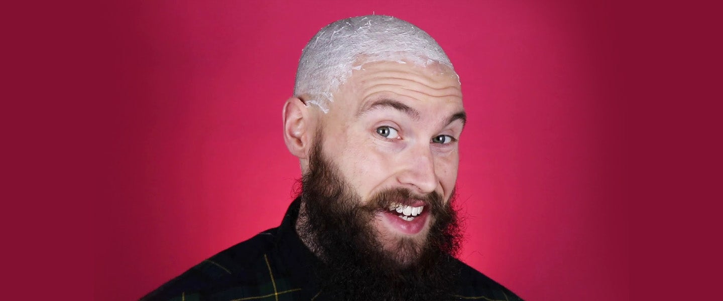 The Guru Helping Men Tell the World They’re Going Bald